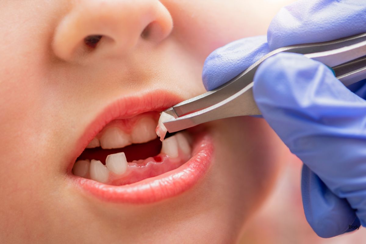 What to Do If Your Child Knocks Out a Tooth: Quick Guide